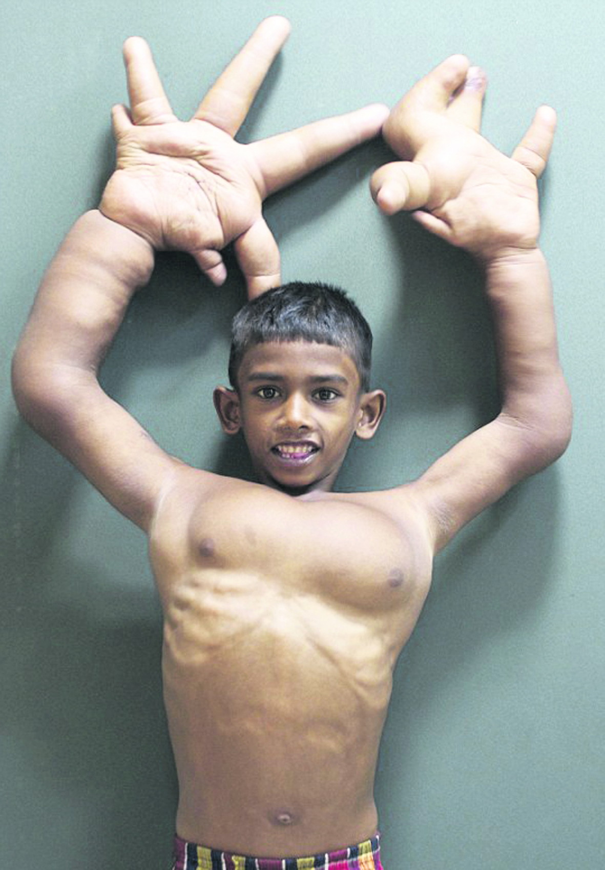 world's biggest hands